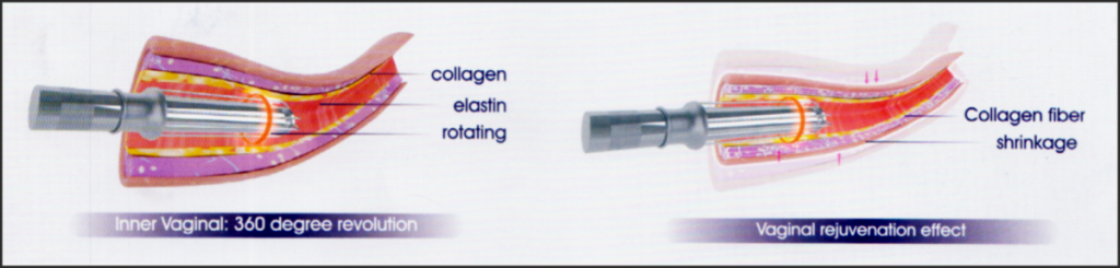 Numi CO2 – Numitech