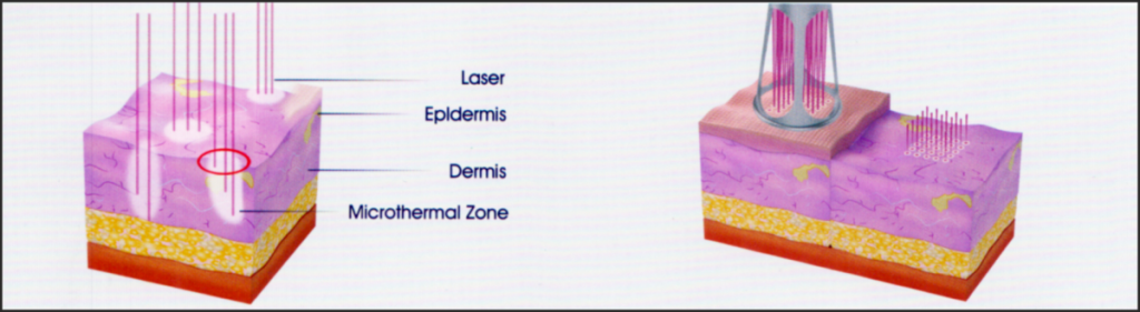 Numi CO2 – Numitech
